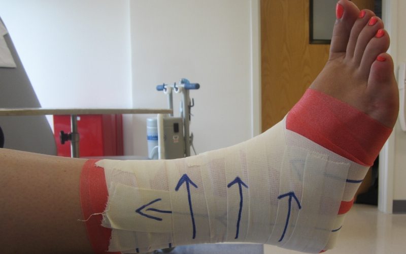 Tobillo lesionado: Consejos para vendarlo | La Nota Latina